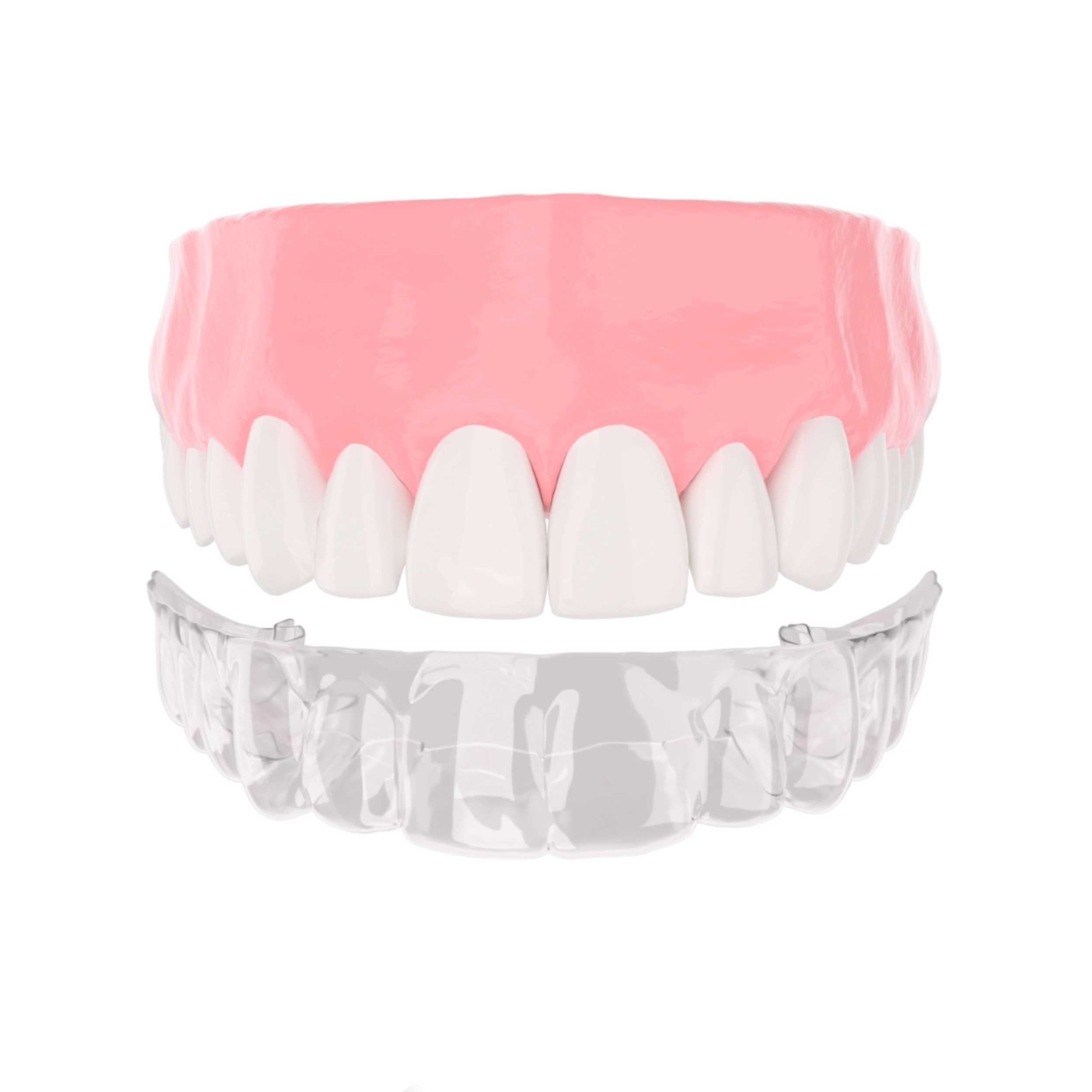 Upper Retainer only – Retainer Xpress